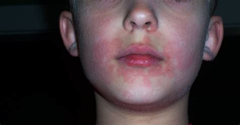 Image result for Unpredictable Reactions