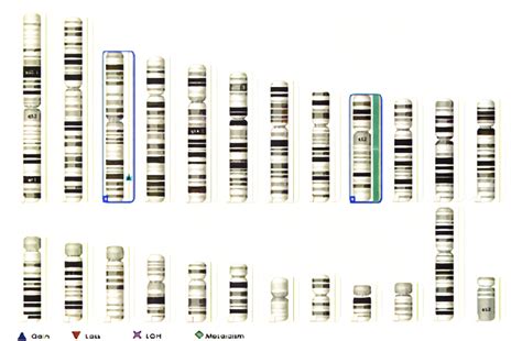 Image result for Duplication Chromosome Microarray