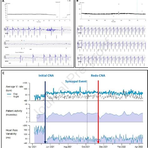 Image result for Inner Loop Recorder