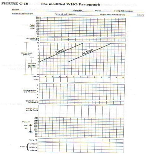 Image result for Normal Partograph