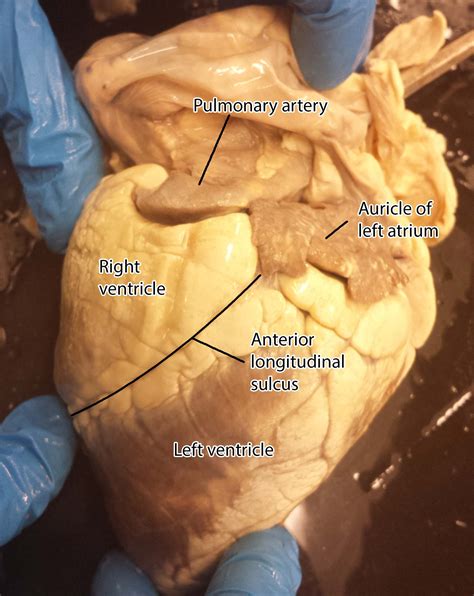 Image result for Human Heart Dissection