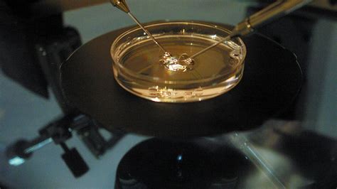 Image result for How Is IVF Done