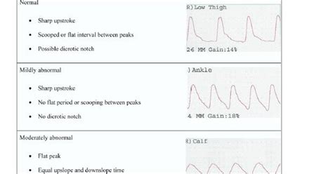 Image result for PVR Recording