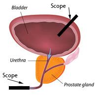 Image result for Urethrogram Technique