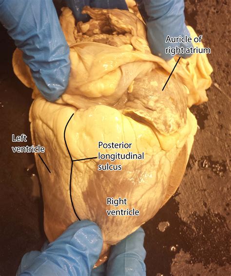 Image result for Human Heart Dissection