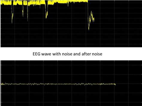 Image result for MATLAB EMG Filter