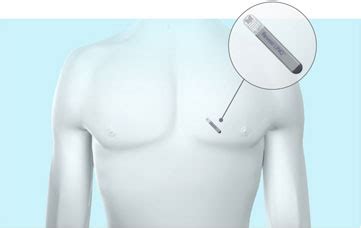 Image result for LINQ Device