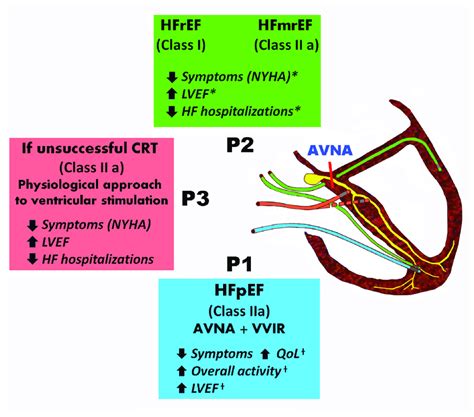 Image result for AV Node