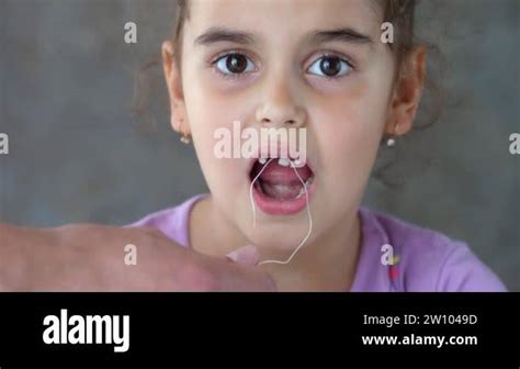 Image result for Tooth Out Pull Fail