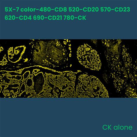 Image result for Multiplex IHC Kit