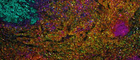 Image result for Multiplex IHC Texture Types Diffuse