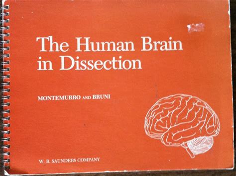 Image result for Human Brain Dissection