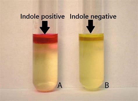 Image result for Indole Test Procedure