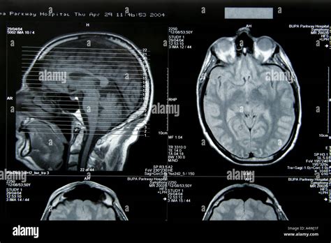 Image result for Cat Scan