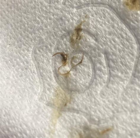 Image result for What Is Pinworm