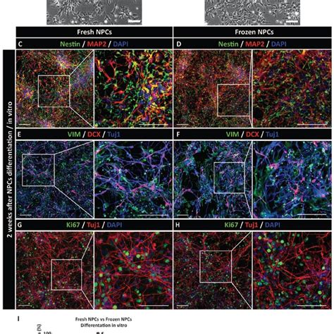 Image result for Yamanaka Discovered Cellular Reprogramming