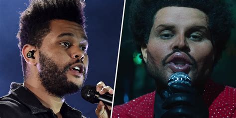 Image result for The Weeknd Botox