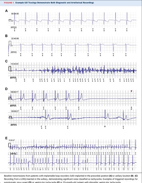 Image result for LINQ Loop