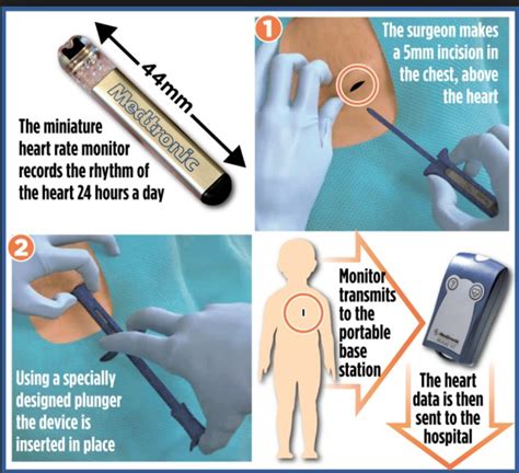 Image result for LINQ Device