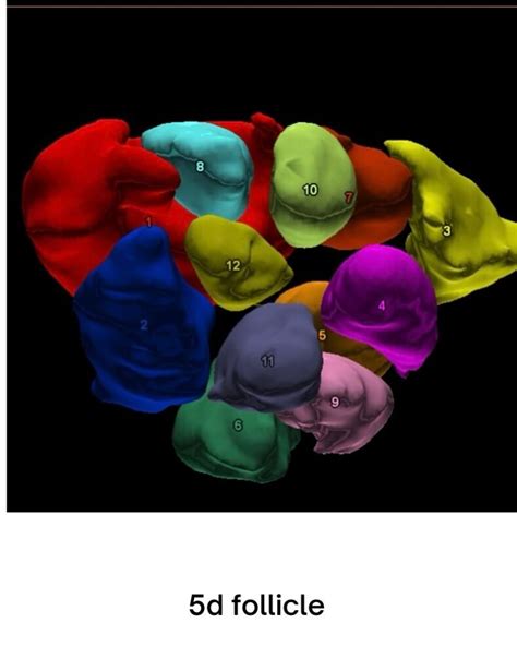 Image result for Follicular Study Scan