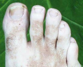 Image result for Toe Jam Cleaner