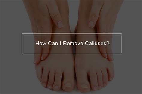 Image result for How to Remove Calluses Forever