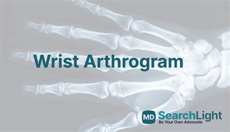 Wrist Arthrogram (Arthrography) - MD Searchlight