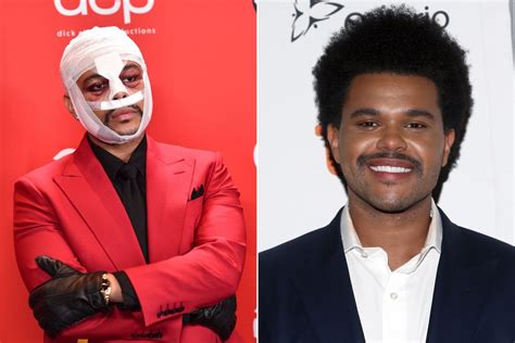 Image result for The Weeknd Botox