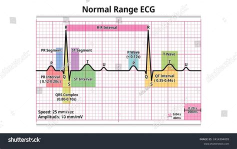 Image result for PR Interval ECG