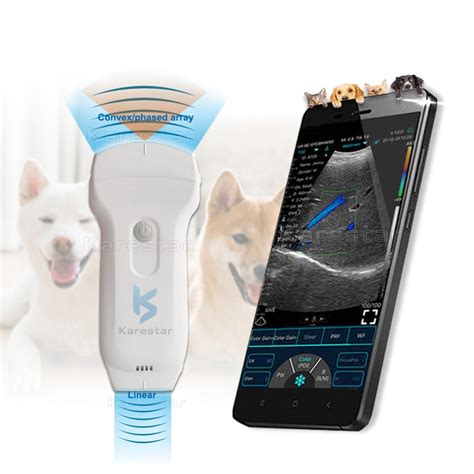 Image result for EPB Ultrasound Linear Array