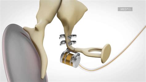 Image result for SoundBridge Examples