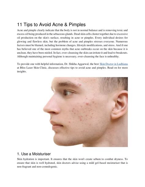 Image result for How to Avoid Pimples