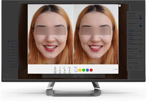 Image result for Medit Software