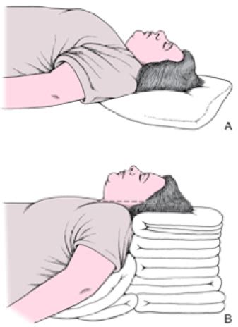 Image result for Intubation Position