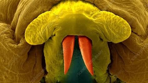 Image result for Bot Fly Larvae Removal