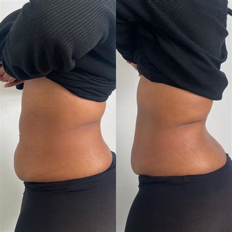 Image result for Body Contouring Boo