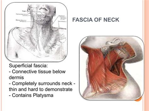 Image result for Types of Neck Dissection