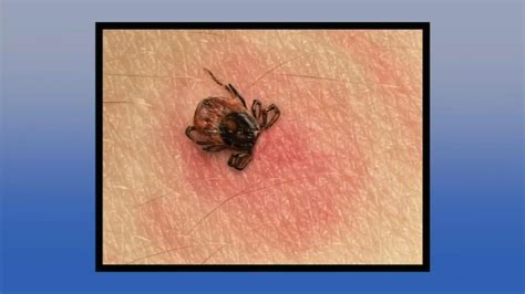 Image result for Testing for Tickles