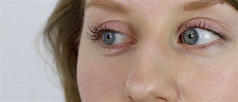 Image result for DUI Eye Test