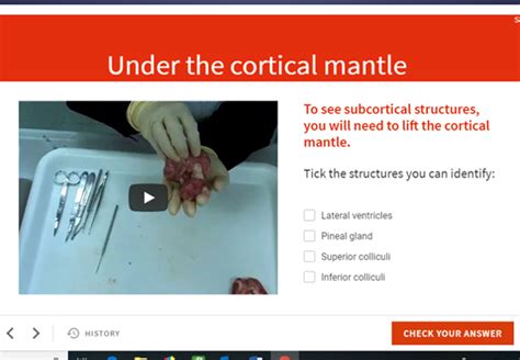 Image result for Brain Dissection