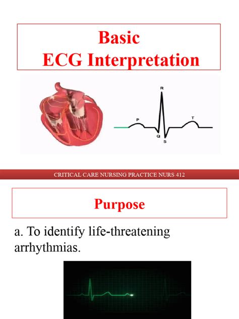 Image result for ECG Step by Step