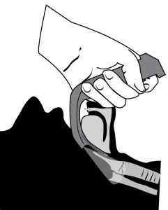 Glidescope: Tricks For Successful Intubation - The Airway Jedi