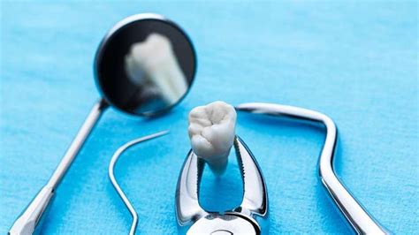 Image result for Tooth Extraction Process