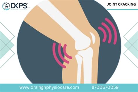 Image result for Joint cracking Risks