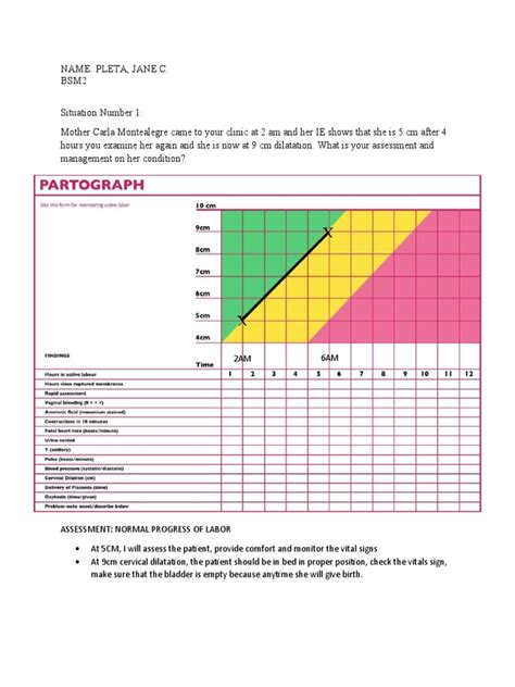 Image result for Types of Partograph