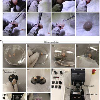 Image result for Mice Brain Dissection