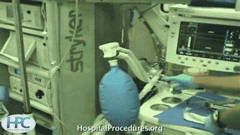 Image result for GlideScope Intubation