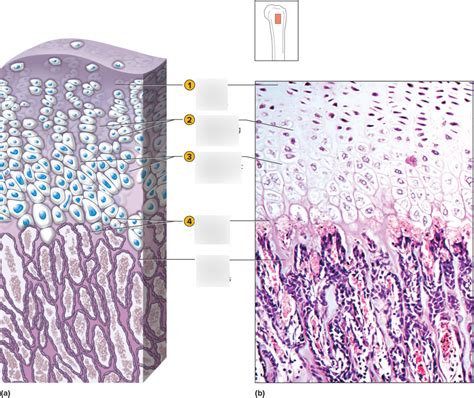 Image result for 2 Types of Bone Formation