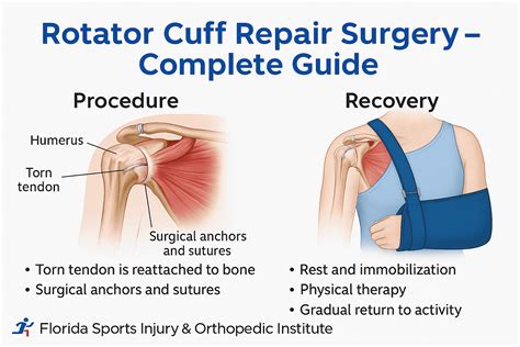 Image result for Rotator Cuff Repair Surgery