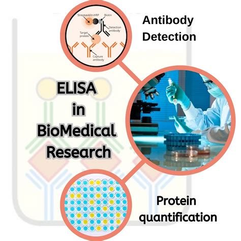 Image result for Estimation of Protein Content Using Elisa